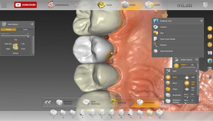 CEREC Stuff: InLab CEREC - 12 unit Smile Design | AlignerMaster.com CE ...