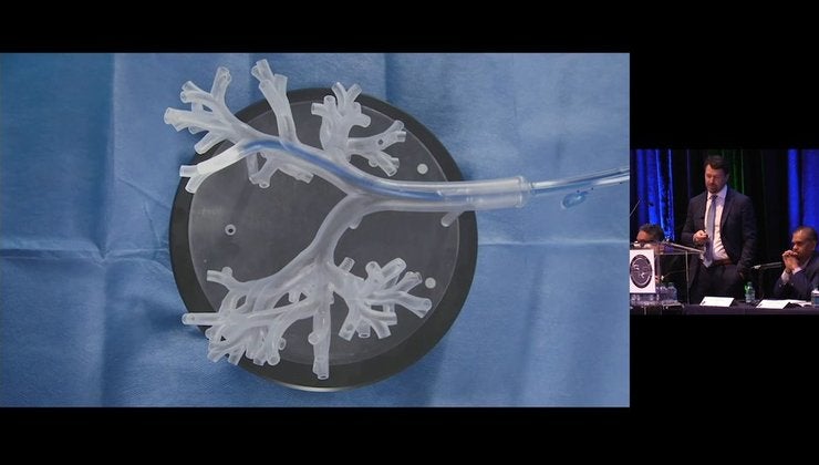 AURIS Robotics: Endoluminal Surgery - by David Mintz, MD - SRS 2019 ...