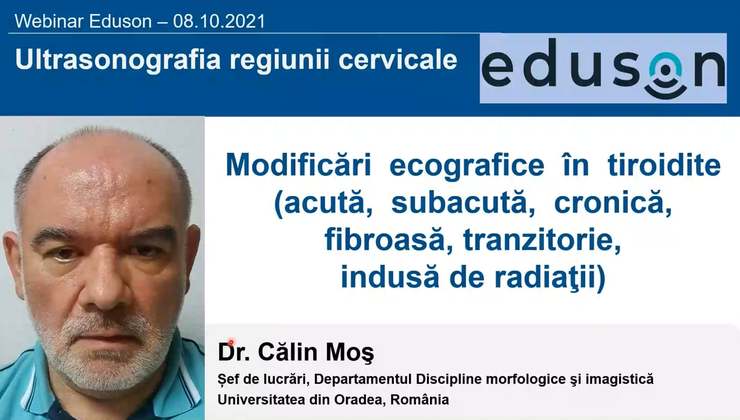 Modificari ecografice in tiroidite (acuta, subacuta, cronica, fibroasa ...