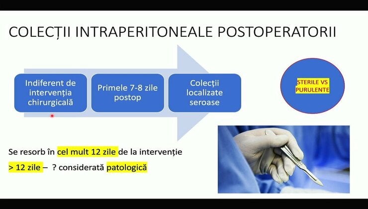 Colectii intraperitoneale:retroperitoneale (abcese, hematoame, colectii biliare, colectii ...
