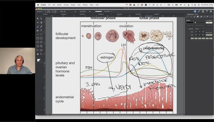 Spis Og Lev Dig Sundere Og Raskere Ved Endometriose • online foredrag ...