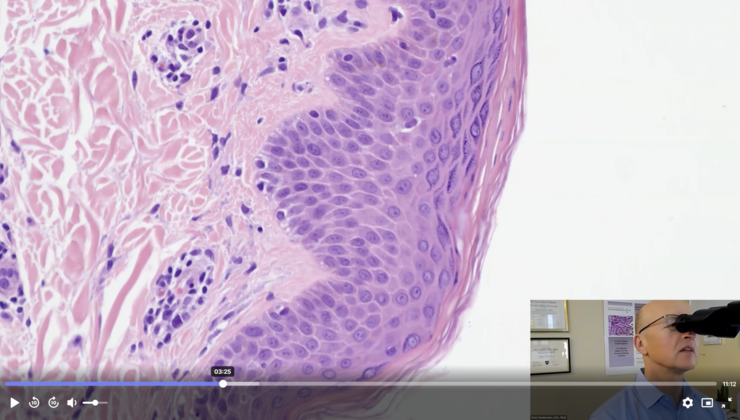 Pityriasis Rosea Like Rash: PRP Or Drug Rash? | Dermpedia