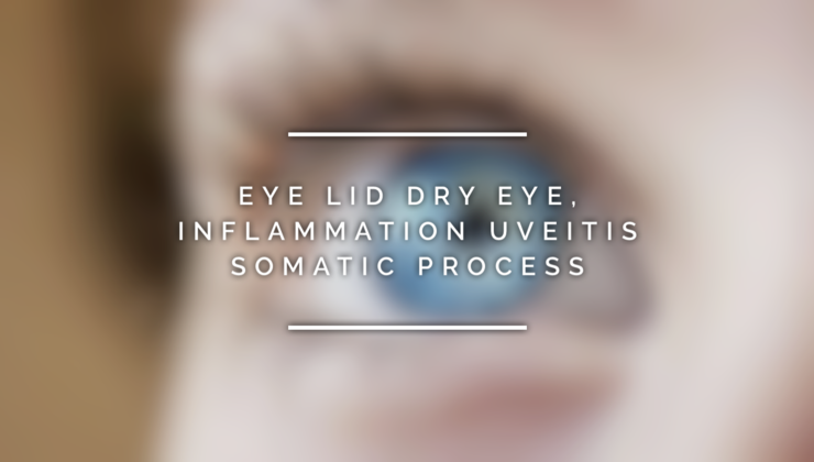 Eye Lid Dry Eye, Inflammataion Uveitis Somatic Processmov