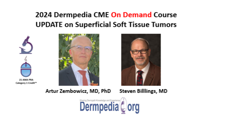 2024 Dermpedia CME Course: Comprehensive Update on Soft Tissue Tumors ...