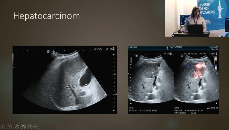 Bazele Ultrasonografiei Imagini Comentate – Normal Si Patologic