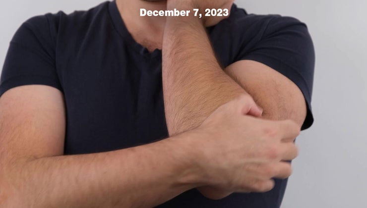 Signature Science: Itching And Scratching | WORLD Watch Schools