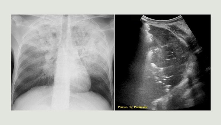 Explorarea US in terapie intensiva. Abordarea pacientului in scop ...
