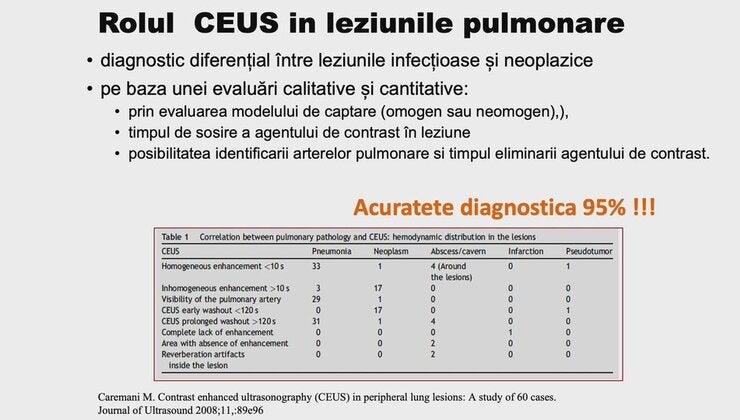 Plaman. Pleure. Abcesul Pulmonar. Pneumonia. Empiemul Toracic