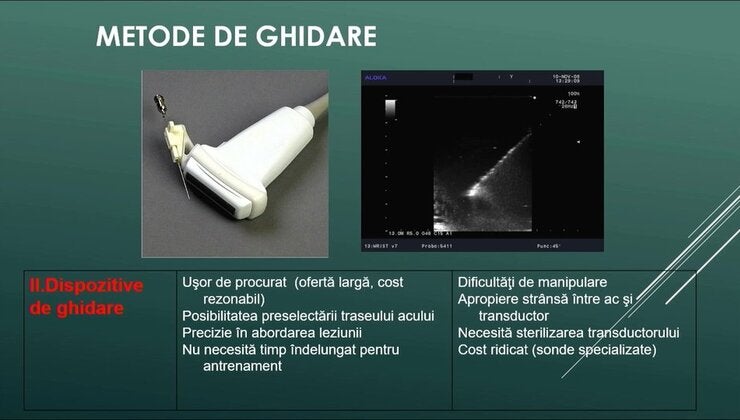 Principiile ecografiei interventionale si principalele utilizari in ...