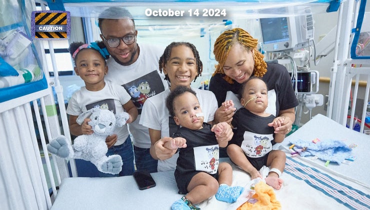 Monday, October 14: Conjoined Twins | WORLD Watch Schools
