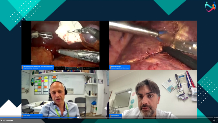 Robotic enucleation of Giant Liver Angioma
