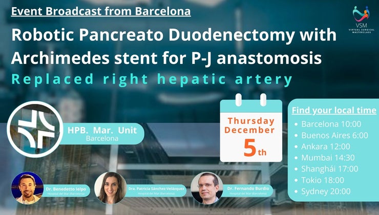 Robotic Pancreato Duodenectomy with Archimedes stent for P-J anastomosis