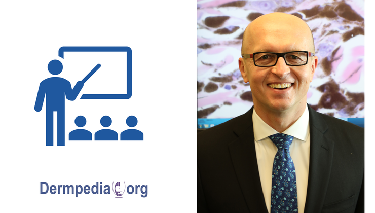 2020: Artur Zembowicz: Ophthalmic Pathology For Dermatopath | Dermpedia