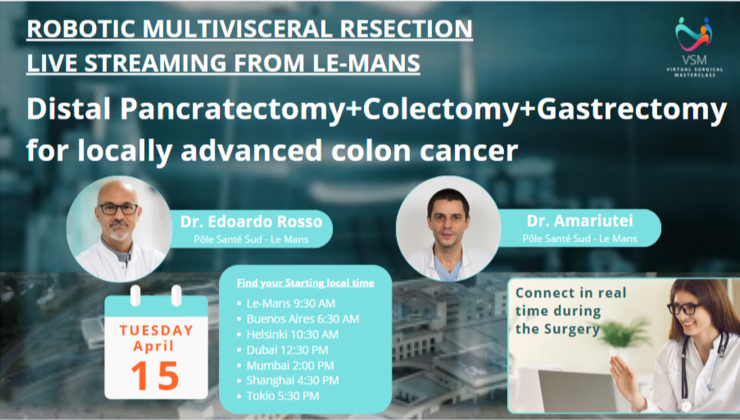 Robotic multivisceral resection: distal pancratectomy+colectomy+gastrectomy for locally advanced ...