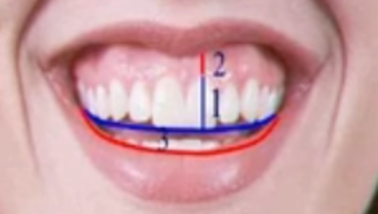 The Art of The Smile-From Diagnosis to Individualized Multidisciplinary ...