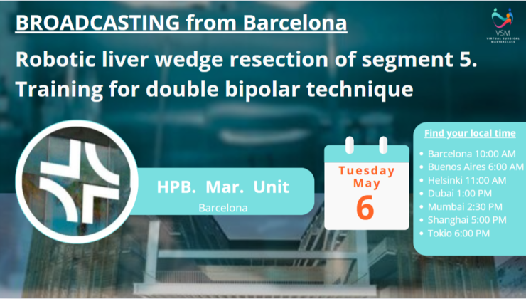 Robotic liver wedge resection of segment 5