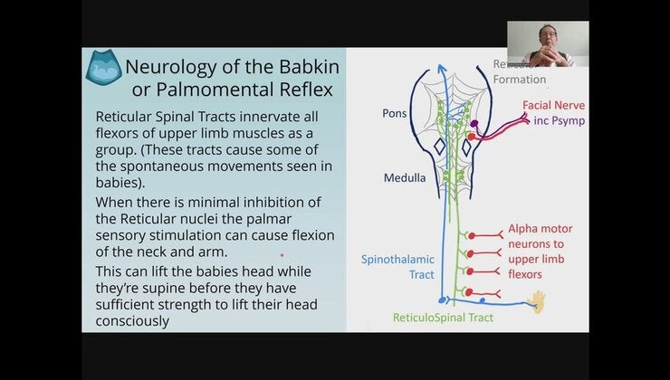 Webinar 5 Ss Development Of Feeding Reflexes And Babkin