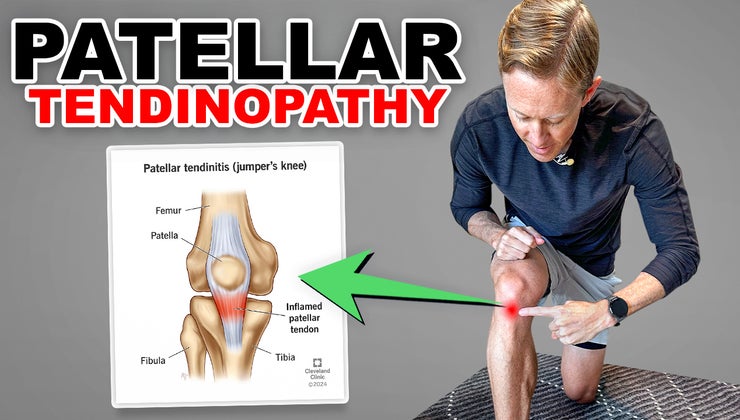 Patellar Tendon Pain (Patellar Tendinopathy)