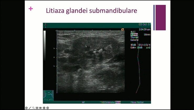 Scoala De Vara Sesiunea Ultrasonografia Capului Și A Gâtului ...
