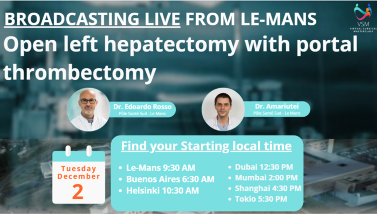 Open left hepatectomy with portal thrombectomy. Le Mans