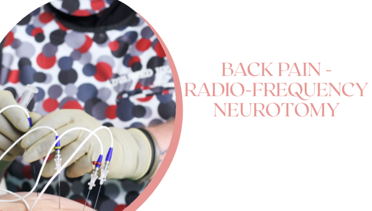 BACK PAIN 24 - RADIOFREQUENCY NEUROTOMY - EDU | Limber Movement Therapy
