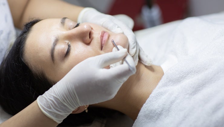 Extractions Part 1 Preparing the Skin & Desincrustation | Professional ...