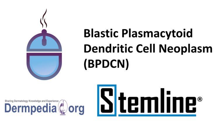 Blastic Plasmacytoid Dendritic Cell Neoplasm (Stemline) | Dermpedia