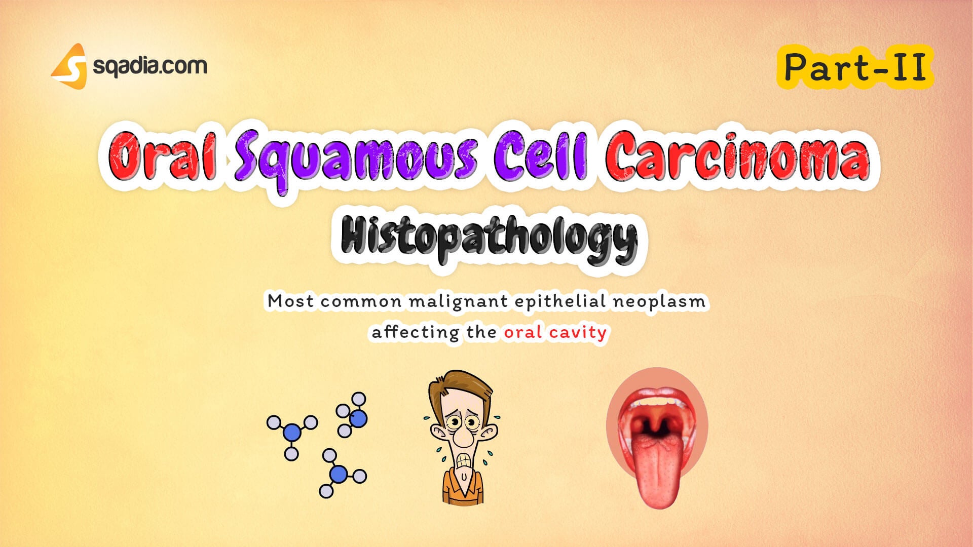 Squamous Cell Carcinoma Histology