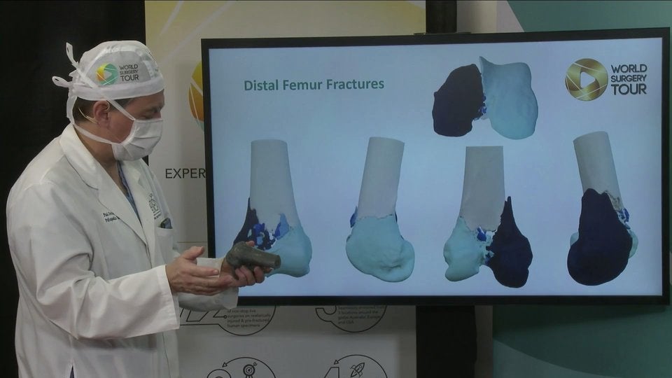 Case Introduction - Open Reduction and Internal Fixation in Distal ...