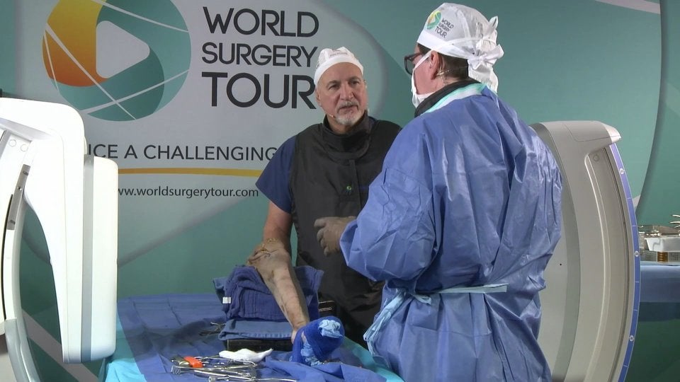 Discussion - Open Reduction and Internal Fixation in Distal Femur Fracture