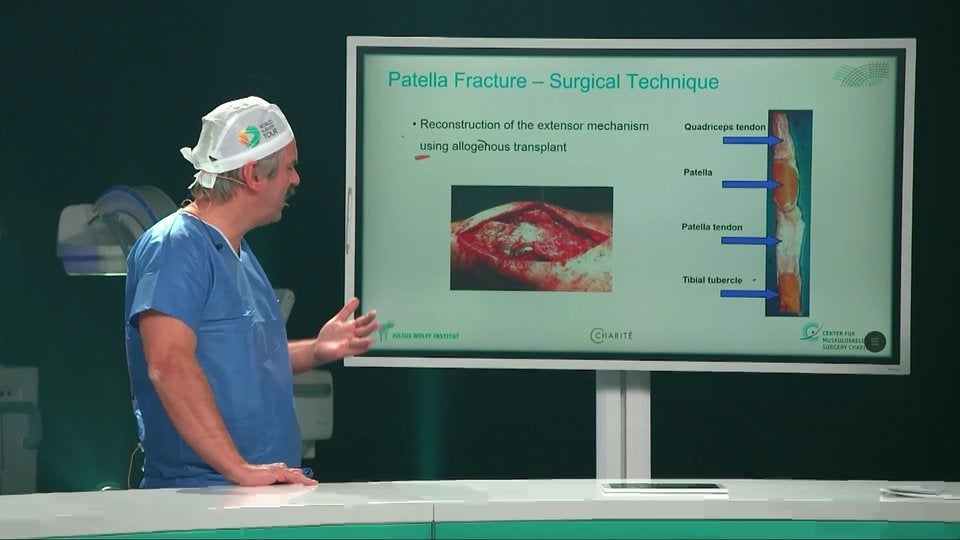 Case Introduction - Reconstruction of the Extensor Mechanism using ...