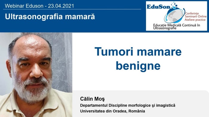 Ultrasonografia mamara