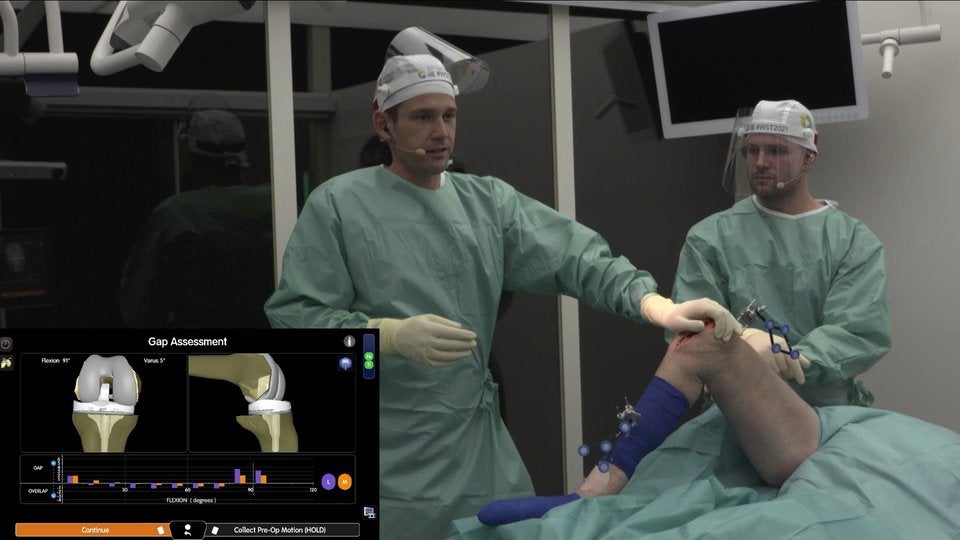 Surgery - Robotically Assisted Total Knee Arthroplasty (TKA) with CORI
