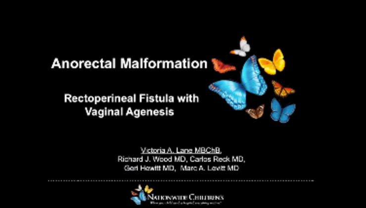 Experts in Surgery | Rectoperineal Fistula with Vaginal Agenesis