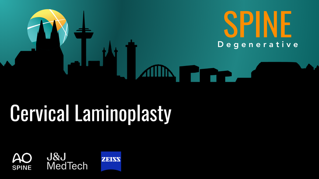 Cervical Laminoplasty