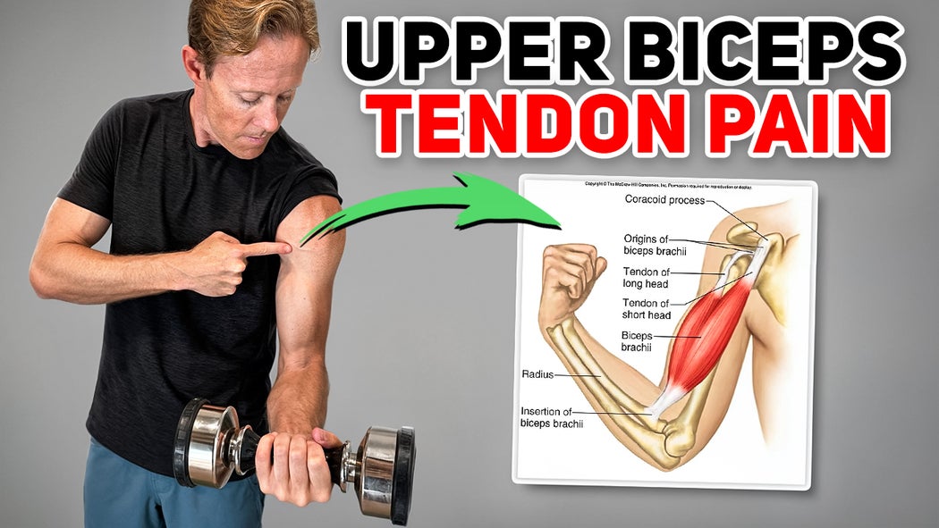 Biceps Tendinopathy (Anterior Shoulder Pain)