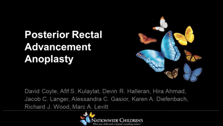 Experts in Surgery | Posterior rectal advancement anoplasty