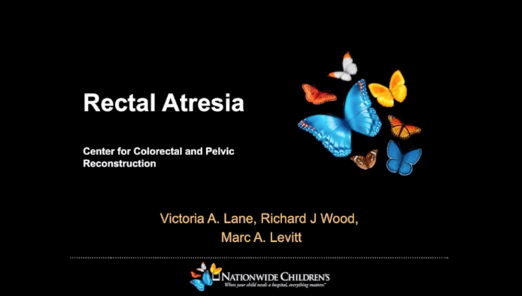 Experts in Surgery | Rectal Atresia NCH-Apple Devices HD (Most ...