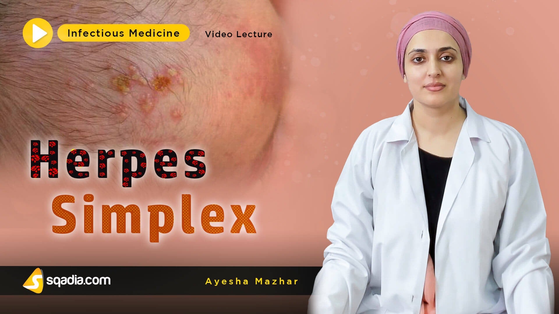 Herpes Simplex - Trailer
