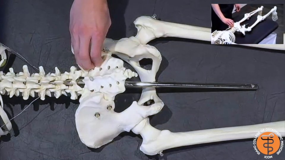 Sacral Shears - ME Treatment | OMT Video Library